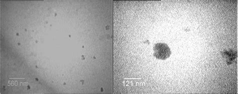 Transmission Electron Microscopy Tem Micrographs Of P6 Niosomes