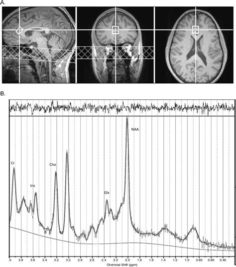 Mrs Voxel And Example Spectra A Voxel Placement In Dorsal Anterior