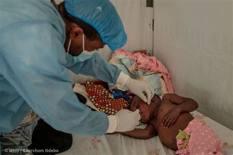 Zimbabwe Reports Its First Mpox Cases As Outbreak Continues To Spread