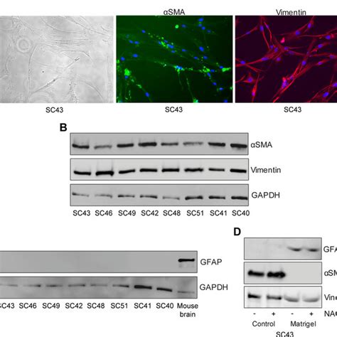 Phenotypic Characterization Of Human Pancreatic Stellate Cells A