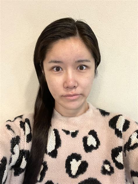 100日後に可愛くなる🏥みさちゃす💄 On Twitter 手術76日目。今日は祖母よっしー（82）に会って遊んだ。顔が変わり、前より良い