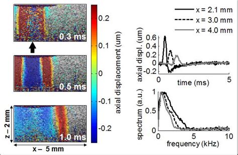 Left Snapshots Of Shear Wave Propagation In A 05 Agar Phantom At Download Scientific