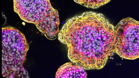 Organoids Offer Insight Into Liver Cancer Technology Networks
