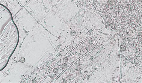 Why Pythium Resistant Spinach And Arugula Is Such A Big Deal