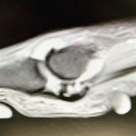 The Sesamoid Bones Are Manchester Foot And Ankle Clinic