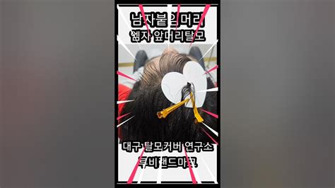 남자엠자 앞머리 붙임머리엠자탈모대구가발shots Youtube