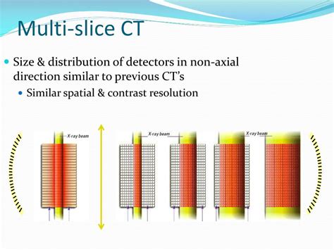 Ppt Multi Slice Ct Powerpoint Presentation Free Download Id5573730