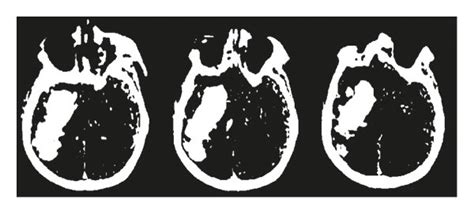 segmentation results of ct images by two algorithms a the original
