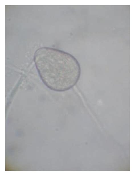Colony Morphology Of P Insolita On A Pda B V8 And C Cma