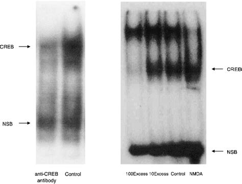 Dna Binding Of Creb To Rat Retina Nuclear Protein 24 H After An Download Scientific Diagram