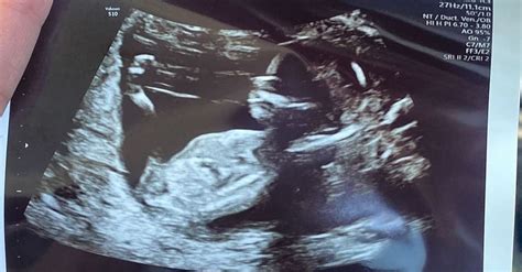 Deze Bekende Radio Dj 57 Wordt Opa Shownieuws