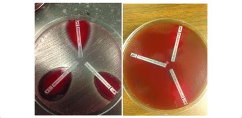 E Test Of Select Antibiotics Tested Against Clostridium Tertium Download Scientific Diagram