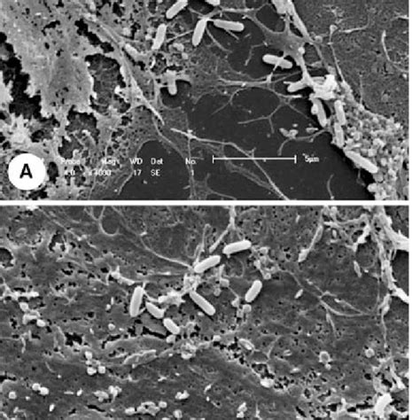 Pdf Characterisation Of Potential Virulence Markers In Pseudomonas