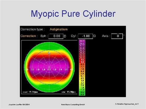 Typical Allegretto Ablation Profiles Note Images Show Ablation