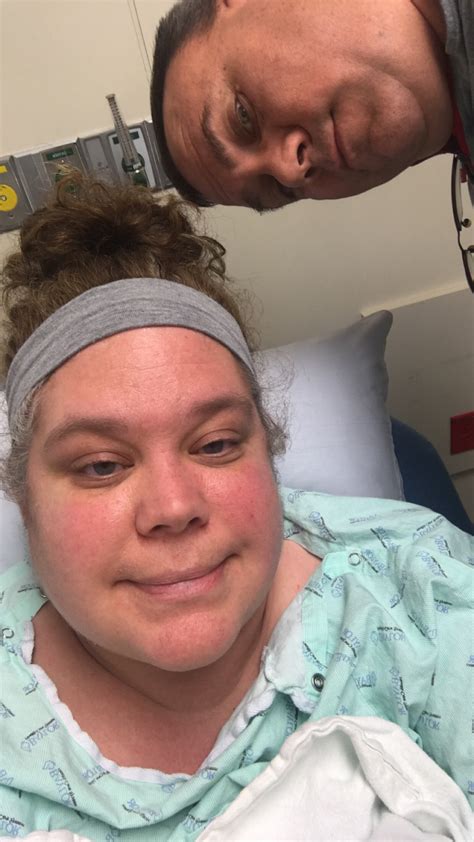 Cushings Disease Loving The Life I Havemy Journey