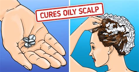 Ways To Stop Dandruff Without Using Chemicals Bright Side