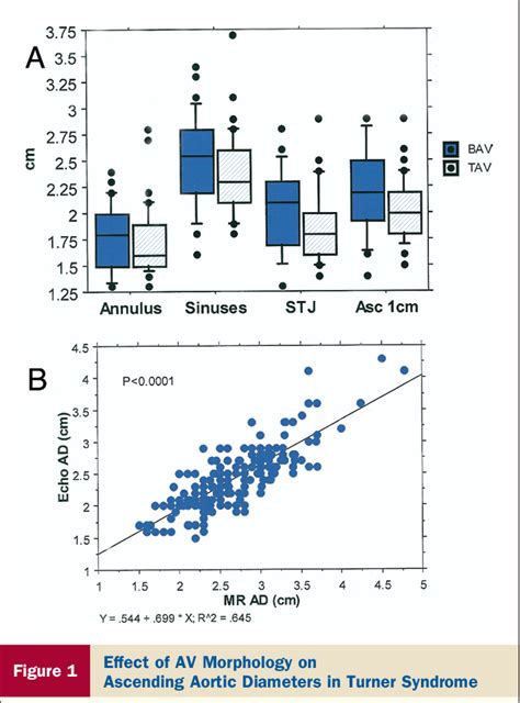 Figure 1 From Aortic Valve Disease In Turner Syndrome Semantic Scholar