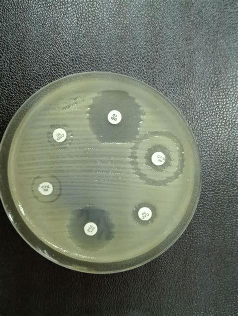 I Have Question About Diagnosis Of A Antibiogram Pattern Of A Bacteria