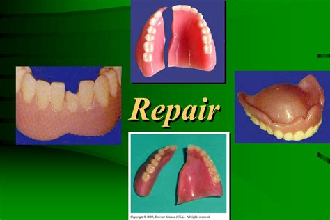 SOLUTION 11 Complete Denture Repair Studypool
