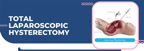Total Laparoscopic Hysterectomy In Andheri Mumbai Dr Shweta Shah