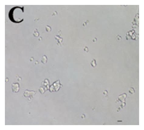 Culture And Spheroid Formation Of Ccscs By Nodal A C Phase Contrast Download Scientific