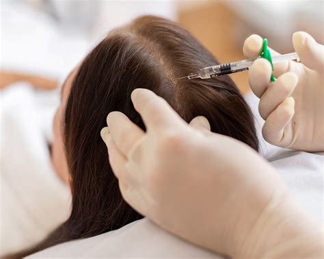 Dr Cyj Hair Filler In Benfleet Aesthetics In Benfleet Essex