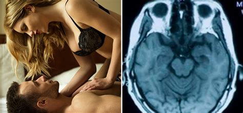 Flickv Nnen Rusar Till Akuten Efter Vulg R Sexakt N R L Karen Tar En N Rmare Titt Kan Han Inte