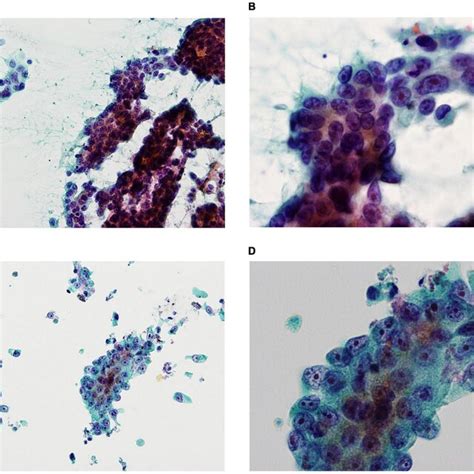 The Specimen Processing For Liquid Based Cytology Lbc The Specimens