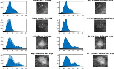 Original And Nl Means Filter Images Histogram Download Scientific Diagram