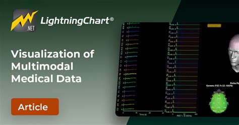 D Medical Imaging Visualization Of Multimodal Medical Data