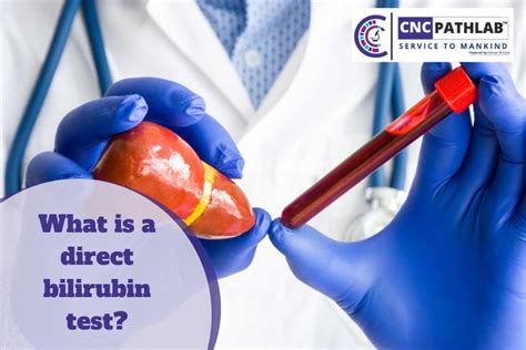 What Is A Direct Bilirubin Test