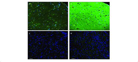 Ph Tau Tg Mice Have Elevated Levels Of Expression Of Activated