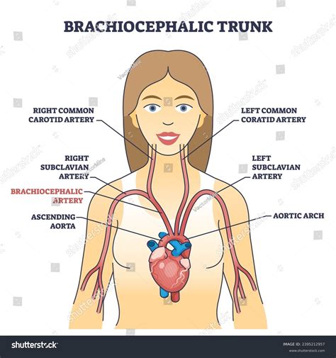 Brachiocephalic Artery Brachiocephalic Trunk Anatomy Branches