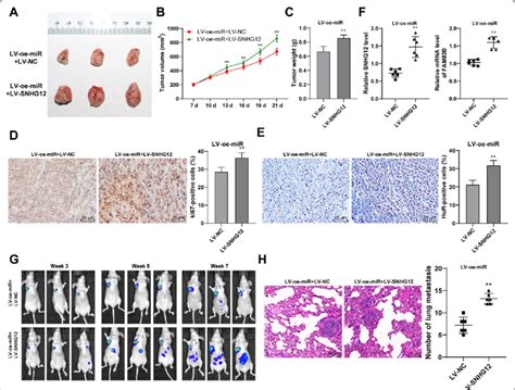 Overexpression Of Mir 140 3p Inhibited The Growth And Metastasis Of Gc