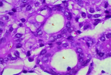 Photomicrograph Showing Intralobular Duct Il Lined By Simple Cuboidal