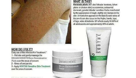 Keratosis Pilaris Aka Chicken Skin