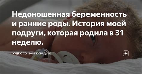 Недоношенная беременность и ранние роды История моей подруги которая родила в 31 неделю