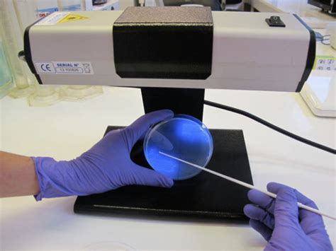 Medium Reagent Cd122 Chromagar For Bacterial Isolation For Stool Samples Clostridium