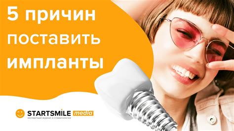 Главные плюсы имплантации зубов Youtube