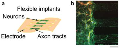 Regenerative Peripheral Nerve Interfaces Rpni A A Schematic