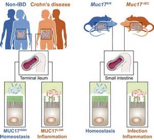 Boosting The Gut Barrier Offers Hope For Crohns Disease Patients