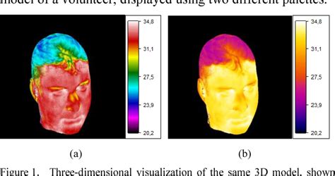 Figure 1 From 3d Thermal Medical Image Visualization Tool Integration Between Mri And