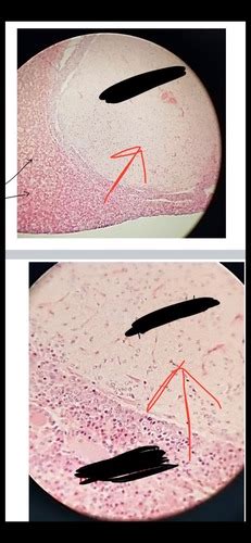 Endocrine Histology Flashcards Quizlet