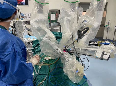 我校华西二院完成全球首例“单孔机器人解剖性肝脏右后叶切除术” 四川大学 Sichuan University