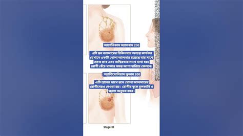 ব্রেস্ট ক্যান্সারের দুটি হোমিওপ্যাথি ওষুধ। Health Youtube