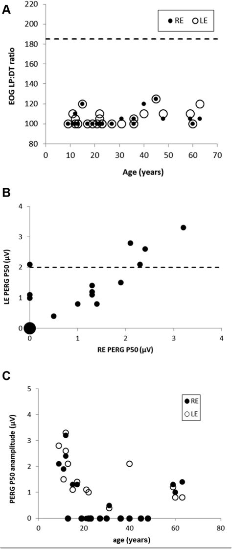 A Graph Showing The Electro Oculogram Eog Light Peak Todark Trough