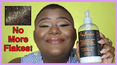 Eczema On Scalp African American