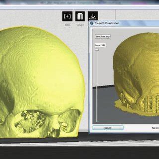 Skull Stripping In InVesalius Medical Image Program Download Scientific Diagram