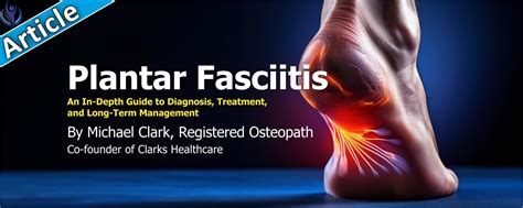 Understanding Plantar Fasciitis Causes Symptoms And Solutions