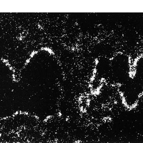 C Myc Expression Induces Increased Proliferation In Transgenic Sbm